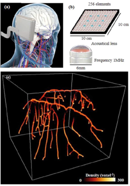 Postdoctoral position – Toward Ultrasensitive 3D Ultrasound ...